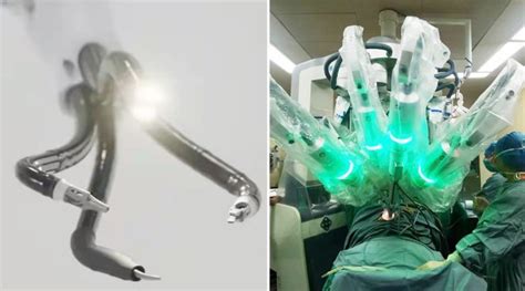 国内首例！协和医院完成国产单孔机器人妇科手术腾讯新闻