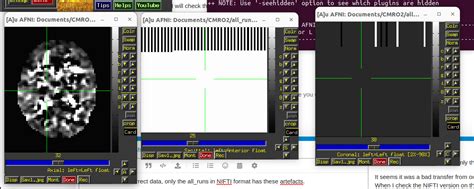 Scaling Step In Afni Proc Gives Infinite Values Afni Neurostars