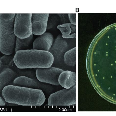 General Genome Features Of Acinetobacter Sp Kj 1 Download Scientific Diagram