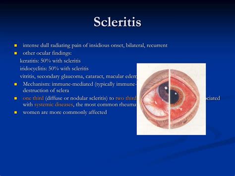 Ppt The Disease Of Conjunctiva 結膜 Sclera 鞏膜 Powerpoint