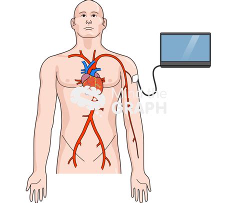 Central Aortic Pressure Measurement Body Full