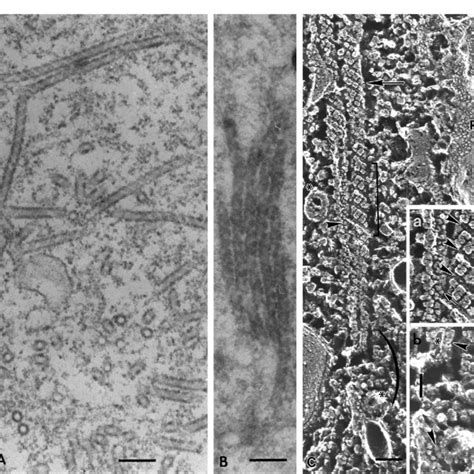 A Microsomal Fraction Was Obtained By Differential Centrifugation And