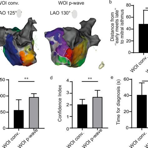 Early Meets Late” Location For Perimitral At A Electroanatomical Map