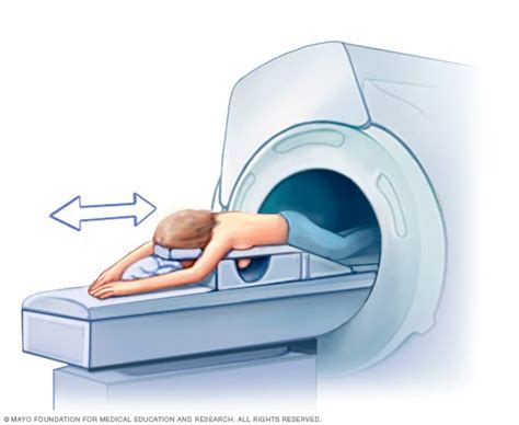 Breast Cancer Diagnosis And Treatment Mayo Clinic
