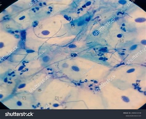 Leptothrix 3개가 넘는 로열티 프리 라이선스 대상 스톡 사진 Shutterstock
