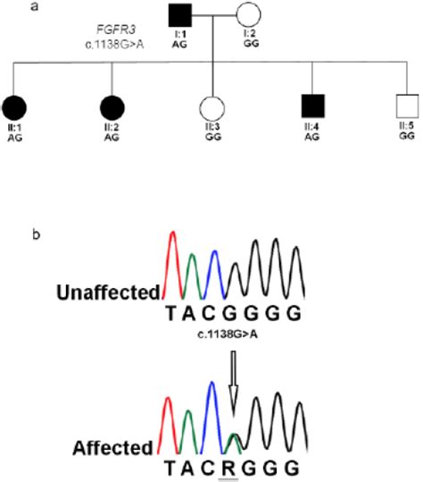 Fgfr3 Mutation Achondroplasia