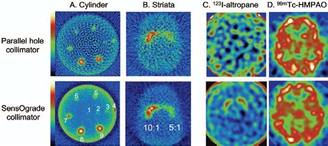 Figure 1 From Performance Of A Novel Collimator For High Sensitivity Brain Spect Semantic Scholar