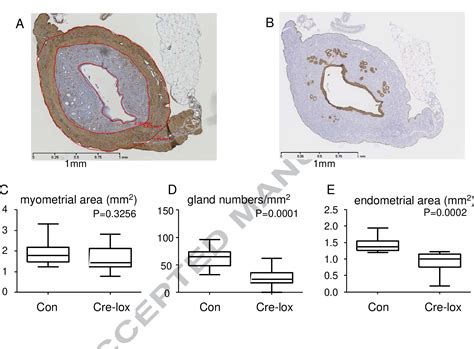 [pdf] Loss Of Apc Function In Mesenchymal Cells Surrounding The Müllerian Duct Leads To