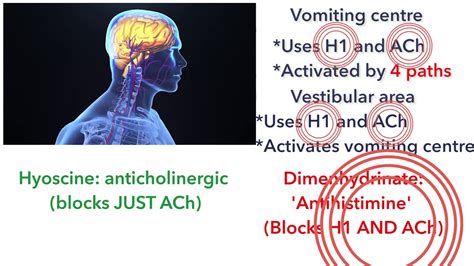 Antiemetics For Motion Sickness Antihistamines And Anticholinergic Medicines Youtube