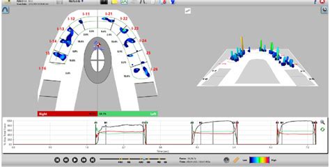 The Delivered Closure Result With No Implants Overloaded And All