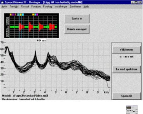 Spectrograms And Speech Devices See Jane Speak