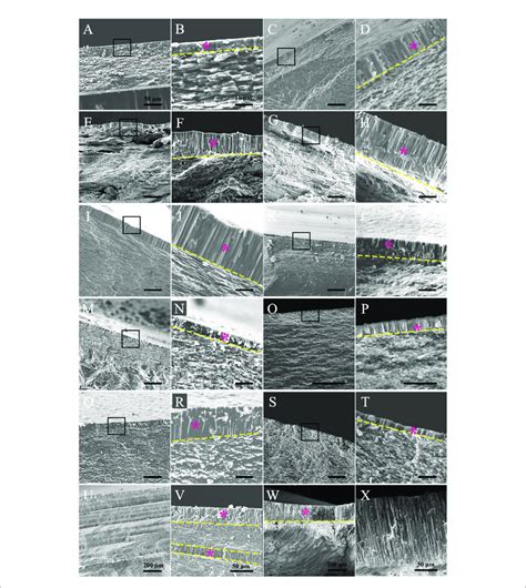 Microstructure Of The Myostracum Layer In Bivalve Molluscs A B