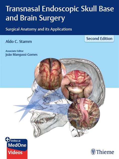 transnasal endoscopic skull base and brain surgery surgical anatomy