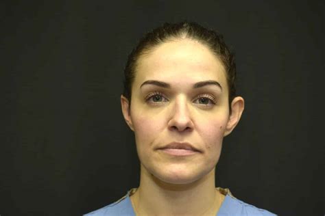 Ear Correction Genesis Plastic Surgery And Medical Spa