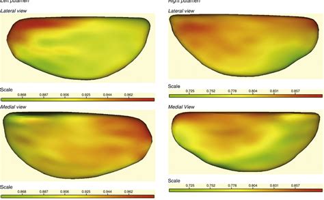 Table 3 From Striatal Morphology Frontostriatal Circuits And Functional Correlates In