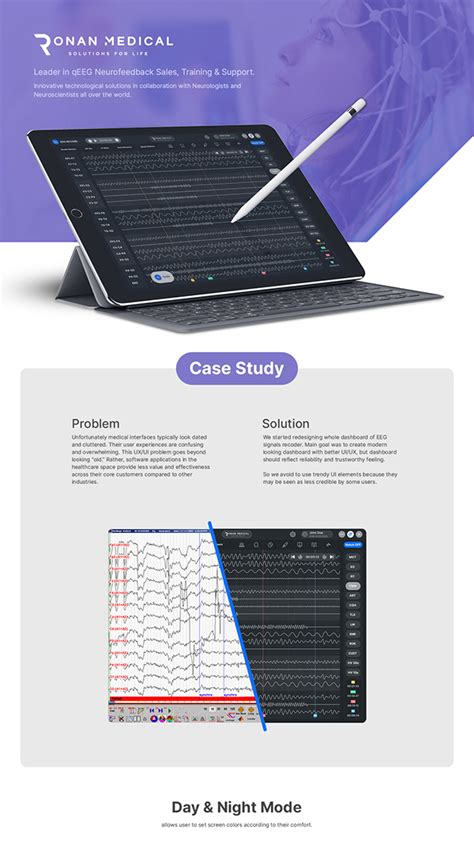 Innovative Medical Dashboard Eeg Records On Behance