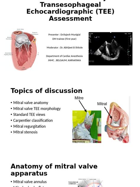Evaluation Of Mitral Valve Tee Approach Pdf Heart Valve Ventricle Heart