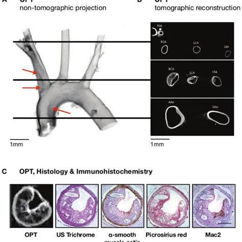 Imaging Of Atheroma In The Aortic Arch Of Atherosclerosis Prone Mice