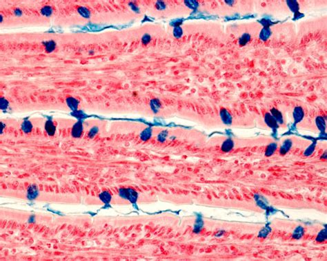 1 000 Cellule Caliciforme Photos Taleaux Et Images Libre De Droits