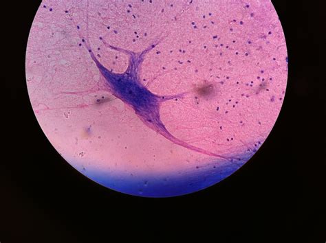 Neuron Microscope 400x