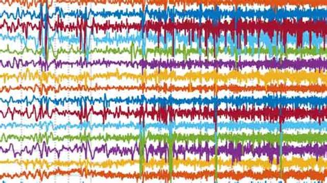 Using Machine Learning To Predict Epileptic Seizures From EEG Data MATLAB Simulink