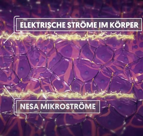 Nesa Therapie Einfach Erklärt Nesaclinics Schweiz