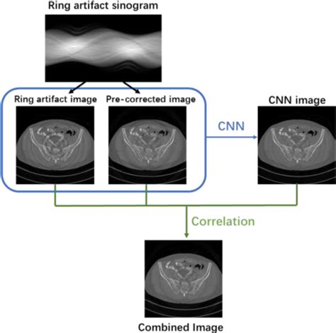 Figure 1 From A Cnn Based Hybrid Ring Artifact Reduction Algorithm For Ct Images Semantic Scholar
