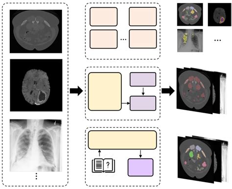 논문 리뷰 Seg Sam Semantic Guided Sam For Unified Medical Image Segmentation