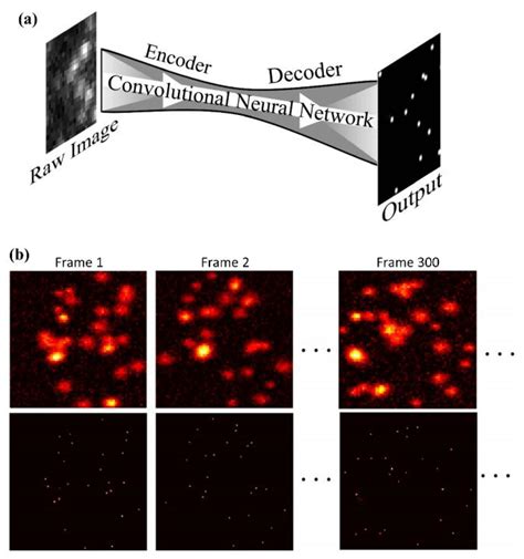 Sensors Free Full Text Current Development And Applications Of Super Resolution Ultrasound