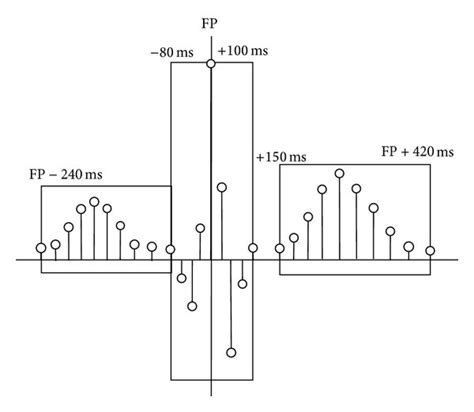 Extraction Of Ecg Morphological Features From Heartbeat Where Fiducial Download Scientific