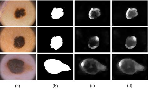 Saliency Maps Using Sparse Reconstruction Errors And Contex Based Error