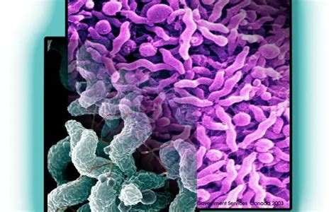 Campylobacter Jejuni Disease Properties And Laboratory Diagnosis Learn Microbiology Online