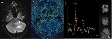 Diffusion A Perfusion B And Spectroscopy C Sequences Of A Brain Download Scientific