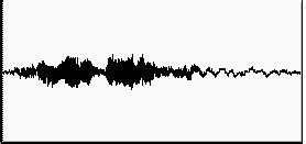 CSD 215 Phonetics Quiz 4 Flashcards Quizlet