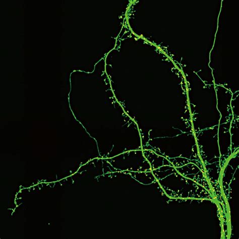 Mouse Hippocampal Neuron Galleries Nikon Instruments Inc