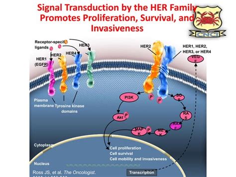 Management Of Metastatic Her2 Positive Breast Cancer Pptx Cancer