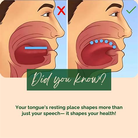 Best 13 Tongue Tie Release Exercises Artofit