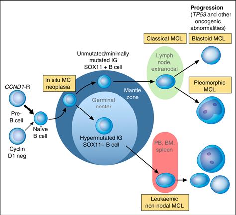 Types Of Hematological Malignancies At Sara Gardner Blog