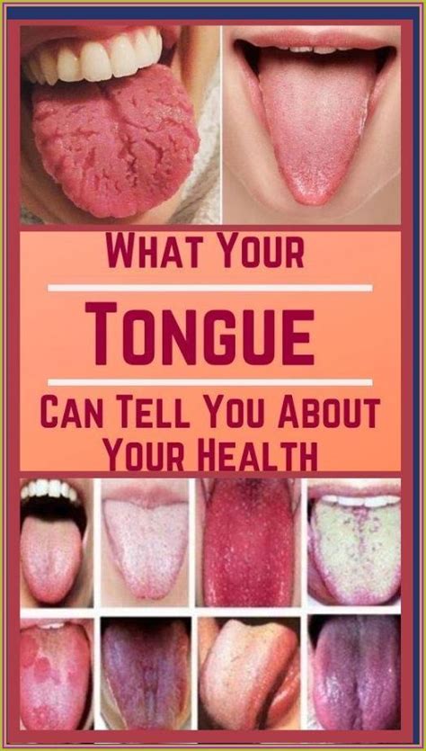 What Your Tongue Is Trying To Tell Artofit
