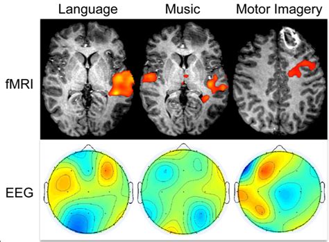Eeg Brain Scan