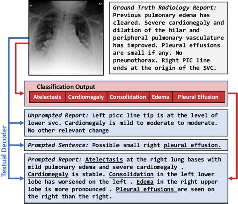 Bidirectional Captioning For Clinically Accurate And Interpretable Models