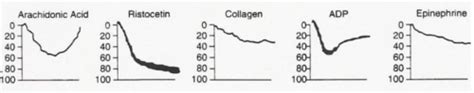 Platelet Aggregation Curves Flashcards Quizlet