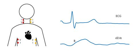 Left Electrode Configurations For Impedance Cardiography Icg Download Scientific Diagram