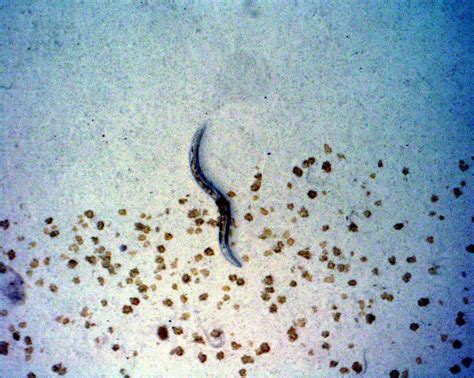 Weird Sex Tri Sexual Worms Use Bizarre Genes To Help Them Survive