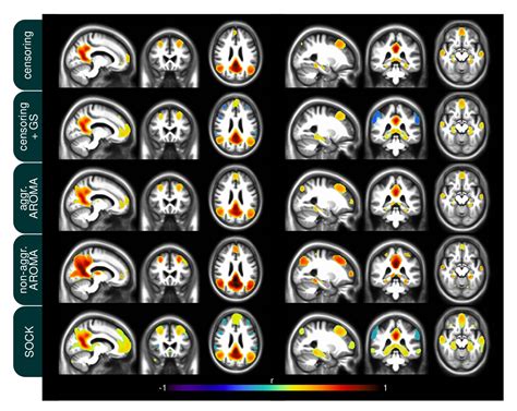 Figure 4 From Evaluation Of Noise Regression Techniques In Resting State Fmri Evaluation Of Figure 4 From Evaluation Of Noise Regression Techniques In Resting State Fmri Evaluation Of