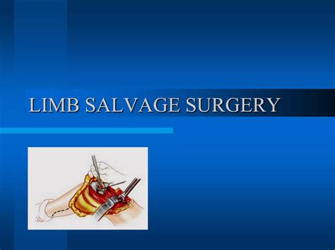 Limb Salvage Ppt