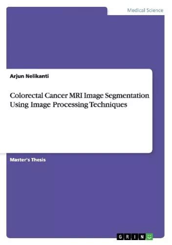Colorectal Cancer Mri Image Segmentation Using Image Processing