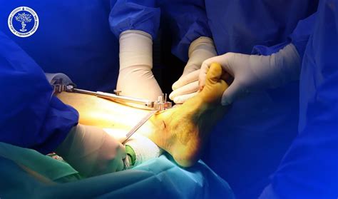 Монголд анх удаа шагайн хиймэл үе солих мэс заслыг амжилттай нэвтрүүлжээ