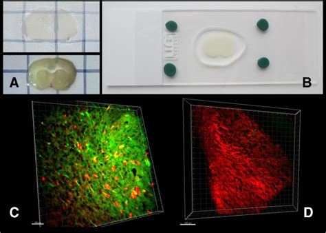 Simplified Clarity Clearing Procedure A Hydrogel Embedded Coronal