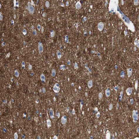 Anti Igsf8 Human Protein Atlas Antibody